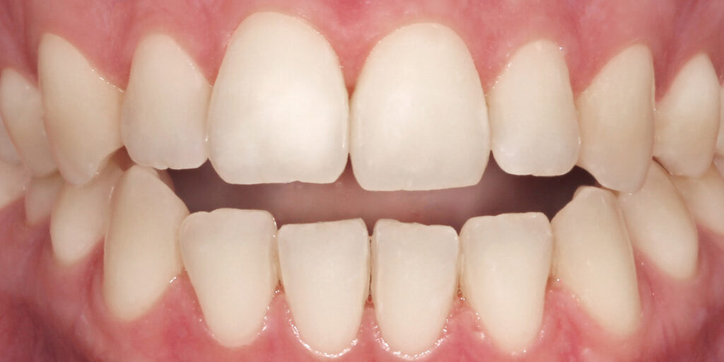 Ormco: 60 anni di ortodonzia. Diamo potere a voi!